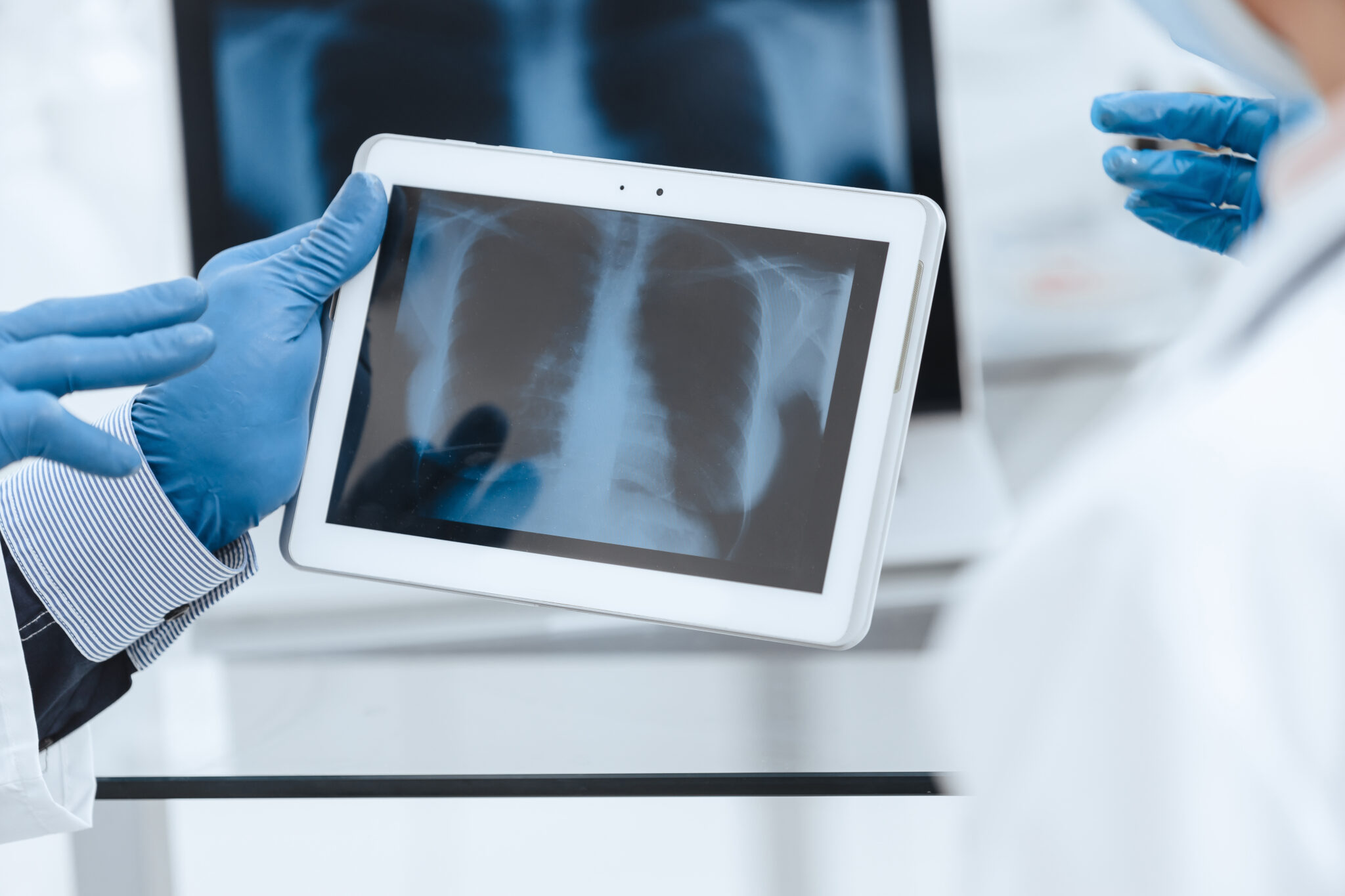 Digital X Rays: What You Need to Know - moderndiagnosticlabandeye